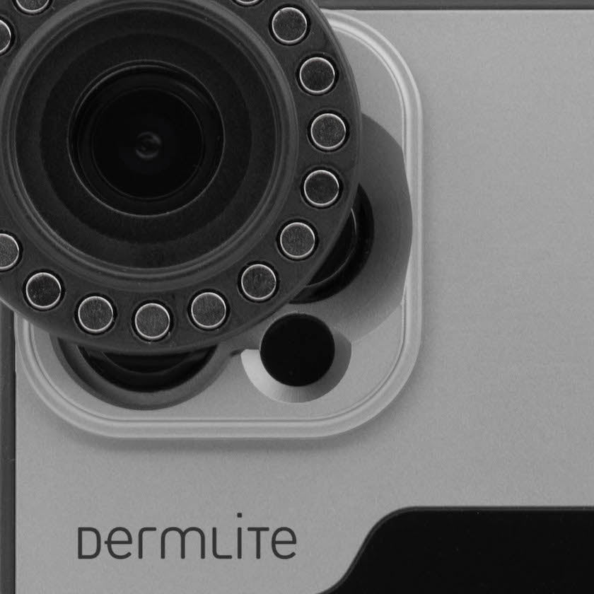 The original polarized dermatoscope – your dermoscopy superpower.