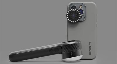 The original polarized dermatoscope – your dermoscopy superpower.